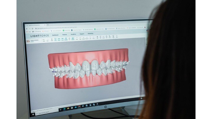 For OSO/DSO Orthodontists, “May the Force Be with You!”